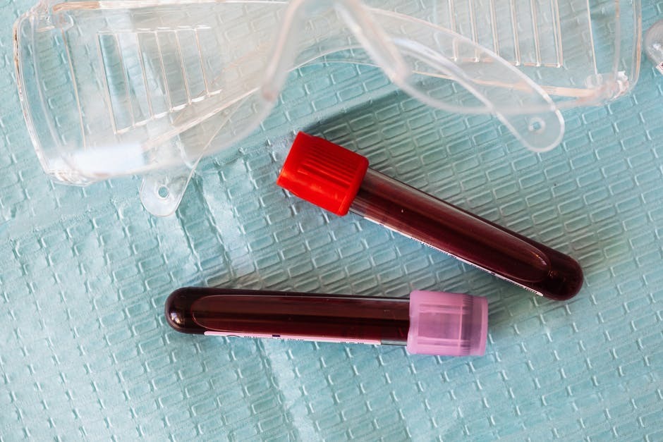 What is the Rule for Lipid Profile Blood Test? | Feelvaleo | Valeo Health