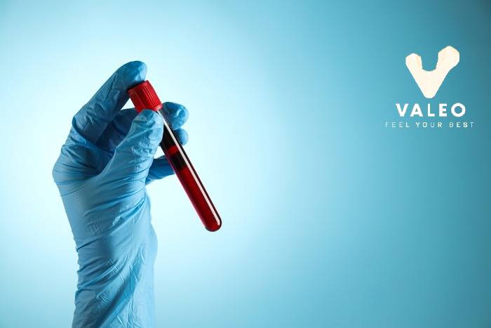 Cost of Blood Tests in Dubai of 10 Annual Panels | Valeo Health