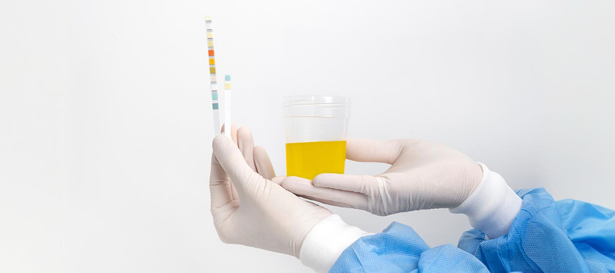 Unlock Health Insights with Urine Analysis Dubai | Valeo Health