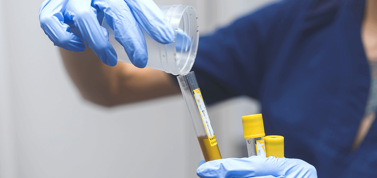 Step-by-step guide about STD Test At-Home | Feelvaleo.com